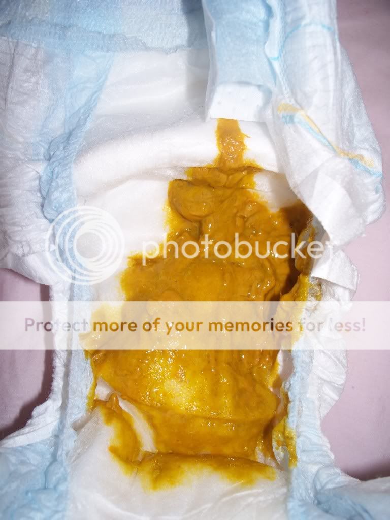 WORRIED!!! Poop question... is this normal (pic inside!) | BabyCenter